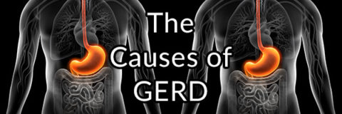 GERD (Heartburn), Causes, Treatment Issues, Supplements, and Relief ...